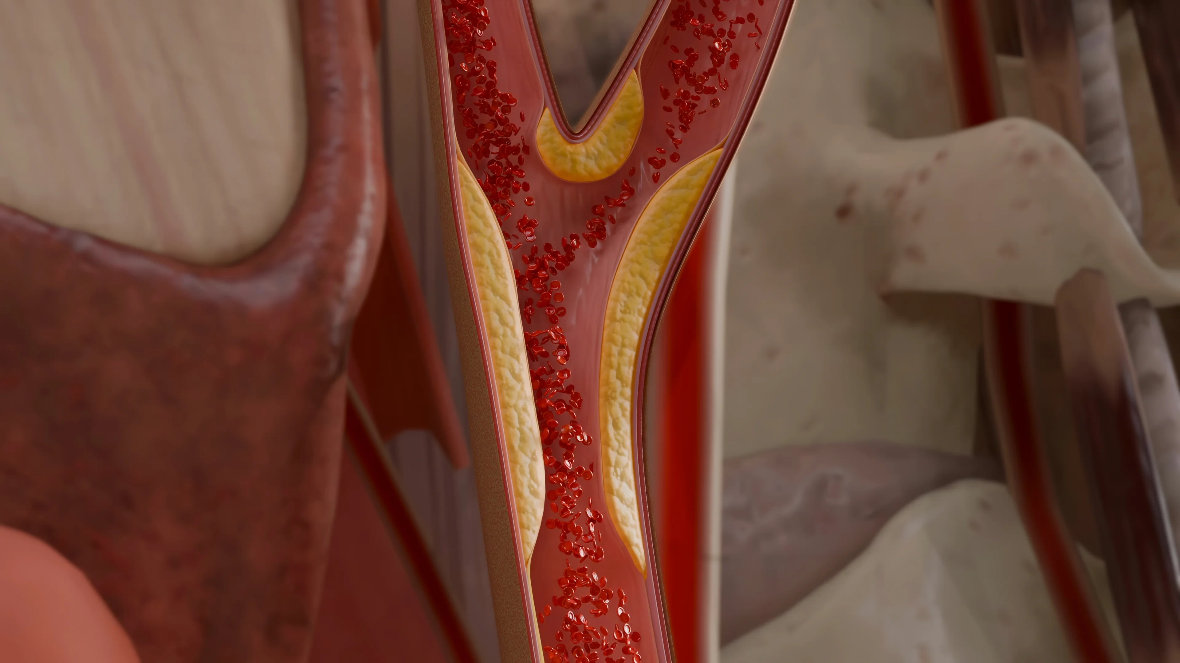 VOKA Wiki: Medical Articles about Human Anatomy, Physiology & Pathology